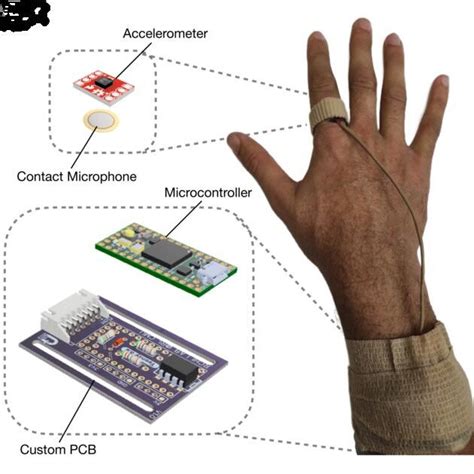 Itching For Data Sensor Measures Scratching Intensity To Help Improve Eczema Treatments Super