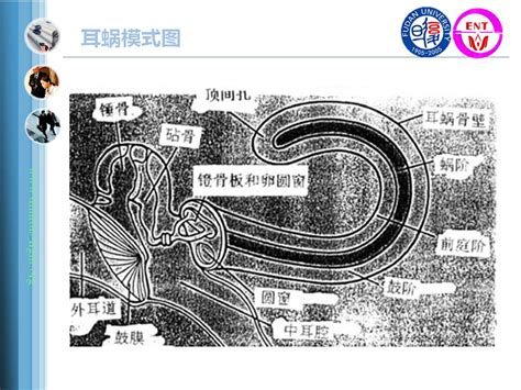 耳蜗的准确位置图打耳蜗钉图片耳蜗位置第10页大山谷图库