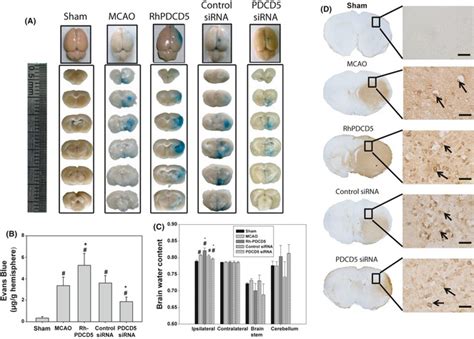 The Involvement Of Programmed Cell Death 5 Pdcd5 In The Regulation Of