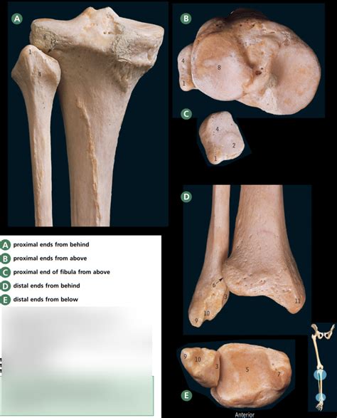 Left Tibia And Fibula Articulated Diagram Quizlet