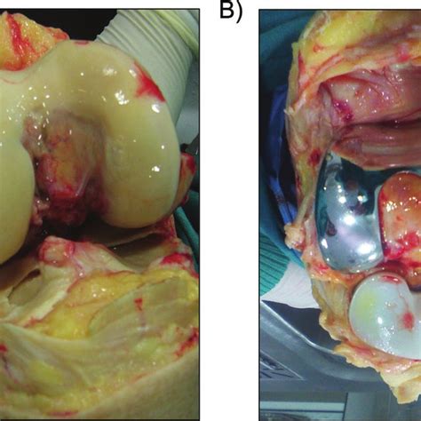 Elements Of The Local Microenvironment That Participate In Regulating