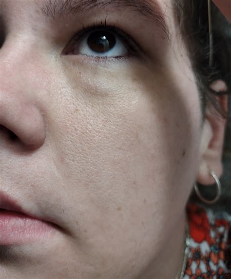 Im Having A Hard Time Figuring Out My Skin Type And If My Large Pores Are Because My Skin Is