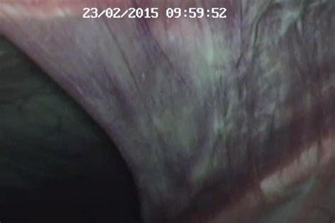 Caudal Limit Of The Abomasopexy On Animal Nº 3 Note The Long Fibrous