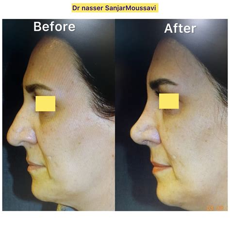 Dr Nasser Sanjar Moussavi Dr Nasser Sanjarmousavi • Instagram Photos And Videos