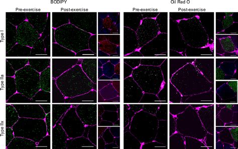 Fibre Type Specific Lipid Staining Using Bodipy And Oro Before And
