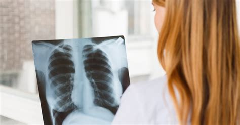 La Tuberculosis Una Enfermedad Infectocontagiosa Prevenible Y Curable La Politica Sj Diario