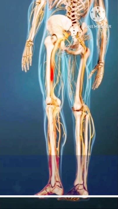 Sciatica 3d Animation Sciatica Animation Shorts Youtube