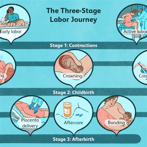 How To Start Contractions Dreamopportunity25