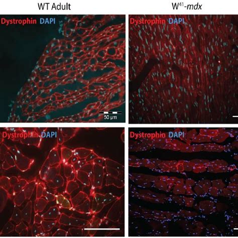 Validation Of Mouse Model Dystrophin Phenotype In W 41 Dmd Mdx Model
