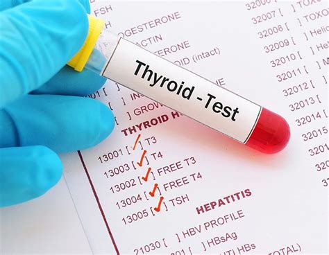 How To Decode Your Thyroid Tests Artofit