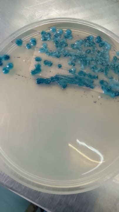 Kluyvera Intermedia Ki Growth Hicrome Uti Media Gnb Microbiology