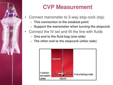 Ppt Central Intravenous Line Placement Powerpoint Presentation Free
