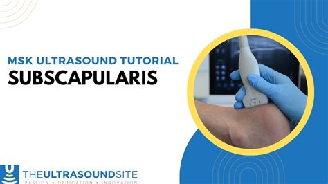 How To Scan The Subscapularis Tendon On Ultrasound Youtube