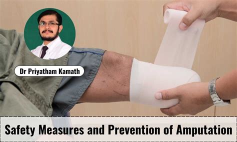 Diabetic Feet Safeguard Measures And Prevention Of Amputation Dr
