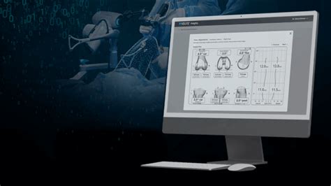 Velys™ Insights Depuy Synthes Jandj Medtech Us