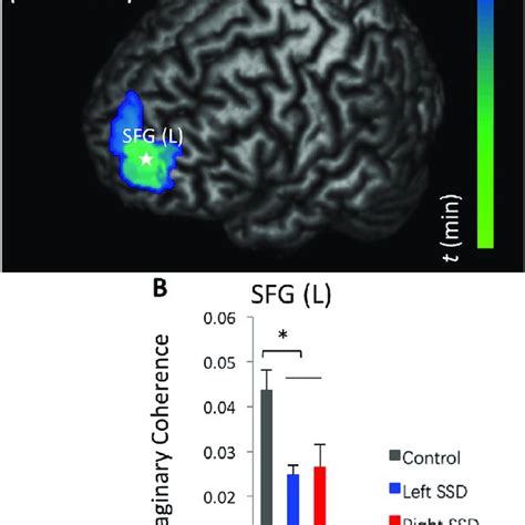 Posterior Cingulate Cortex Seeded Functional Connectivity Difference In Download Scientific