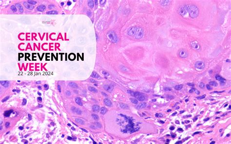 Cervical Cancer Prevention Week 2024 Ahlab