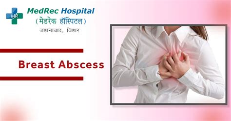 Breast Abscess What It Is And What Are The Treatment Optio