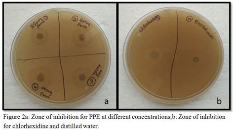 Evaluation Of Anticariogenic Efficacy Of Pomegranate Punica Granatum