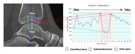 Graphic Showing An Example Of An Intensity Projection Through The Download Scientific Diagram