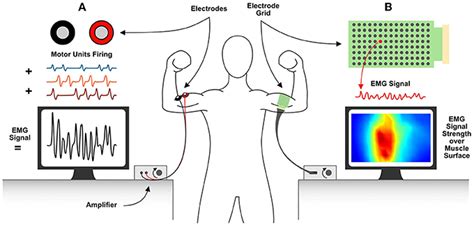 The Pop And Color Of Our Electrified Muscles · Frontiers For Young Minds