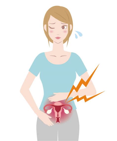 Endometriosis Illustrations Royalty Free Vector Graphics And Clip Art