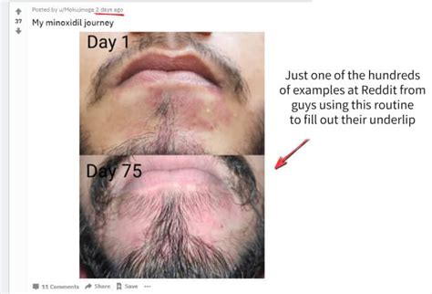 Beard Not Growing Under Lip Heres The Secret To Fill The Gaps