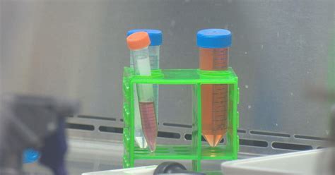 At Home Rapid Hiv Tests Being Developed By Colorado State University
