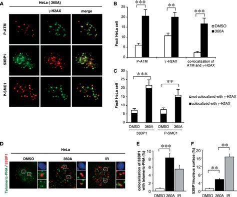 360a Induces Dna Damage Signaling Ac 53bp1 And Phosphorylated Forms