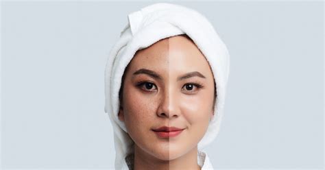 These 4 Natural Ingredients Are Great For Reducing Pigmentation Setu