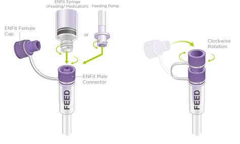 Enfit Syringe Connector At Nancy Colon Blog