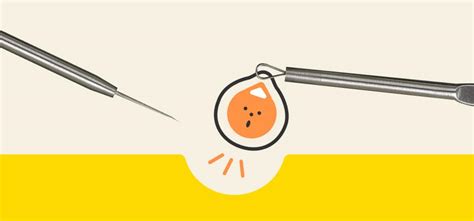 Acne Extraction Breaking Down The Benefits And Risks