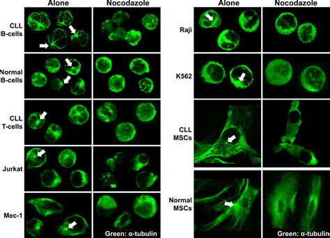 Leukaemic Cells From Chronic Lymphocytic Leukaemia Patients Undergo