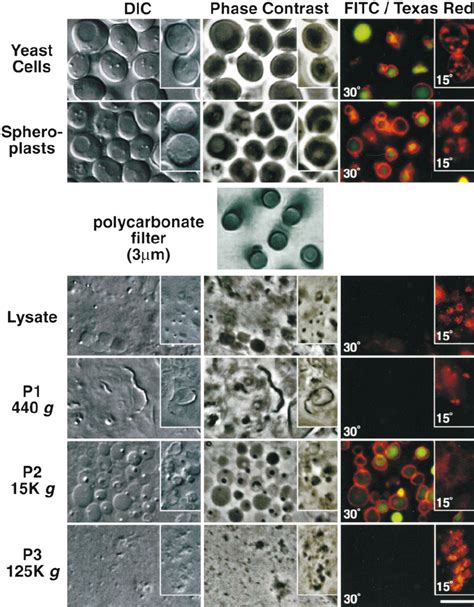 Light Microscopy Of Cell Free Membrane Pellets After Polycarbonate