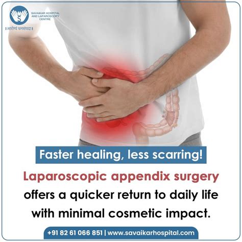 Savaikar Hospital On Linkedin Appendix Symptoms Laparoscopic