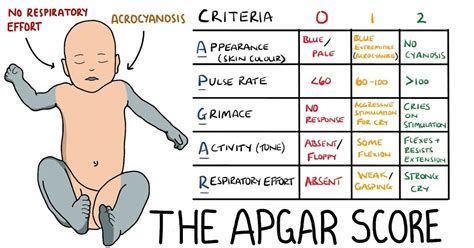 Mega Mover Empire — The Apgar Scoring System