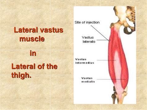 Ppt Different Sites Of Injections Powerpoint Presentation Free