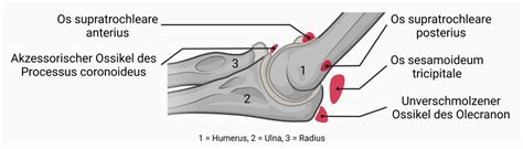 Akzessorische Knochen Am Ellenbogen Doccheck