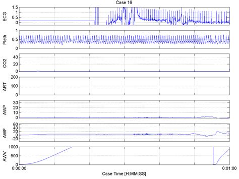 Case 16 Waveform Plots 60 Second Plots