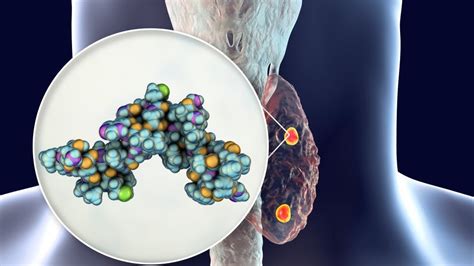 Ascendis Presents Additional Data For Transcon Pth Clinical Trials Arena