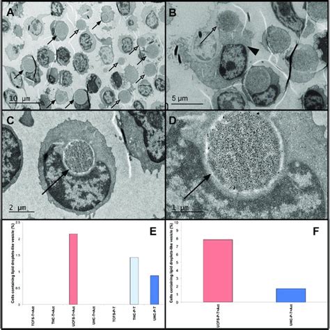 Tem Micrographs Of Platelets Giant Platelets And Platelet Aggregates Download Scientific