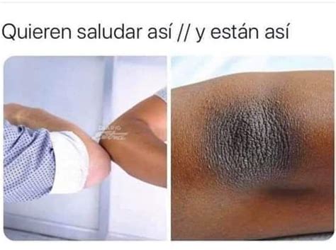 Jajaj Creo Que Todos Sabemos Quienes Son Los Que Tienen Los Codos Asi