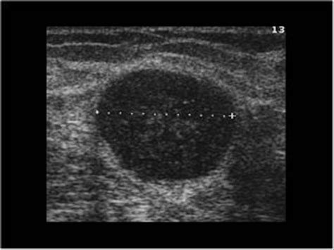 Musculoskeletal Joints And Tendons 65 Hip Groin And Buttock Case 6