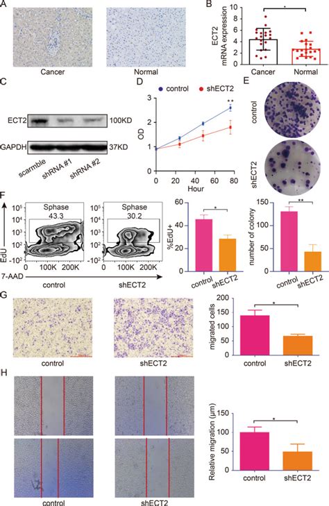 Ect2 Overexpression Promotes The Polarization Of Tumor Associated Macrophages In Hepatocellular