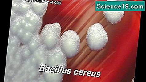 Bacilluse Ekspressioonisüsteemi Eelised Ja Puudused 💫 Teaduslikud Ja