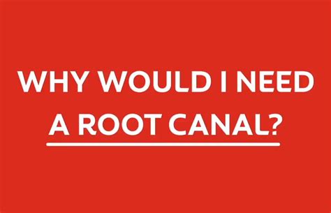 Root Canal Leaflet Colgatetalks