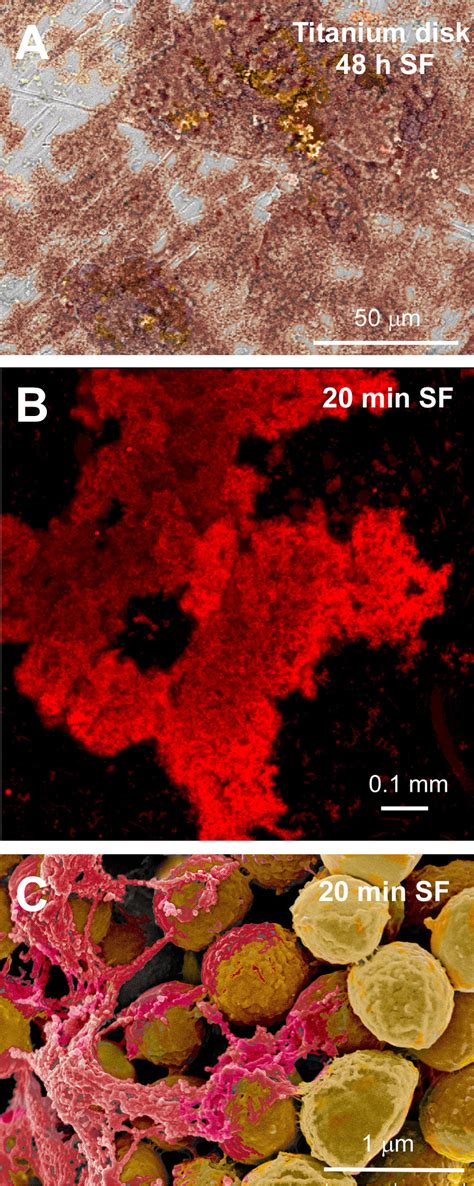 Synovial Fluid Promotes Multicellular Aggregation Of Staphylococcus