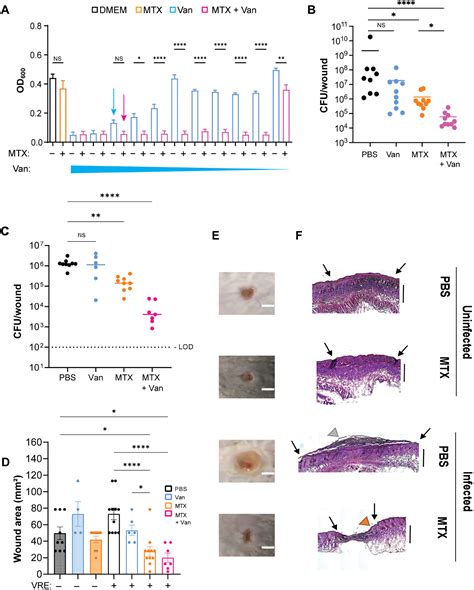 研究人员开发出治疗万古霉素耐药细菌的新型联合疗法 知乎