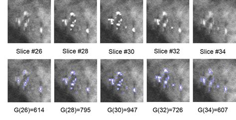 Figure 3 From Multi‐domain Features For Reducing False Positives In Automated Detection Of