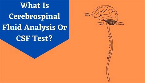 Cerebrospinal Fluid Analysis Test Overview Purpose And Procedure Livlong
